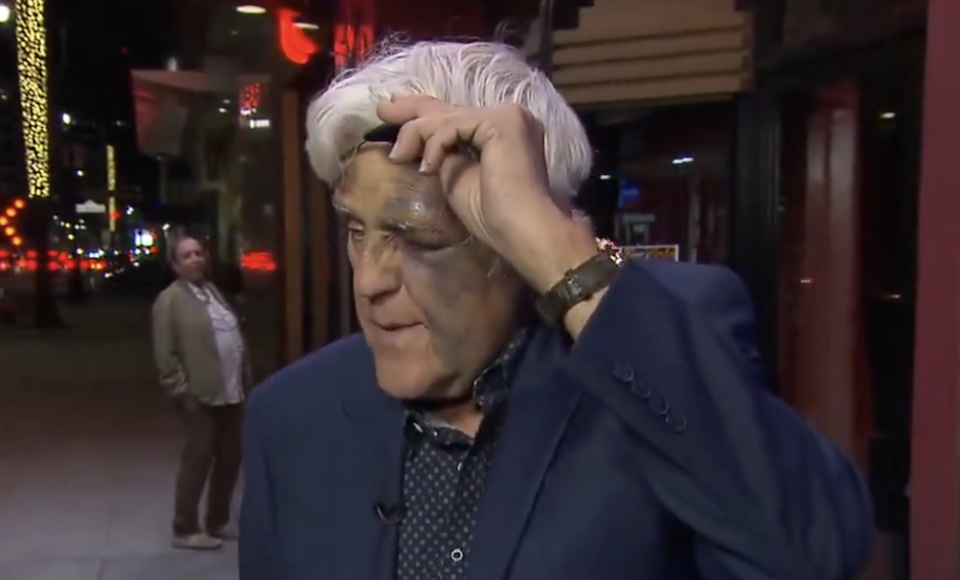 Jay Leno’s Says He Injured His Face After A Fall | Stories Ongoing